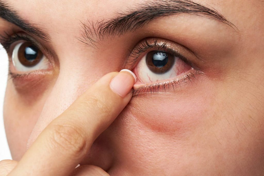 Understanding Eye Pressure Range: Key Insights